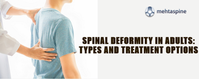 Spinal Deformity in Adults: Types and Treatment Options
