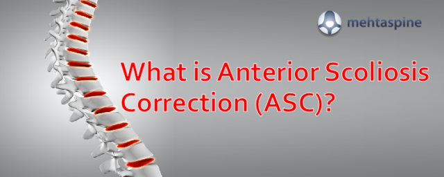 What is Anterior Scoliosis Correction (ASC)? | Mr Jwalant S Mehta