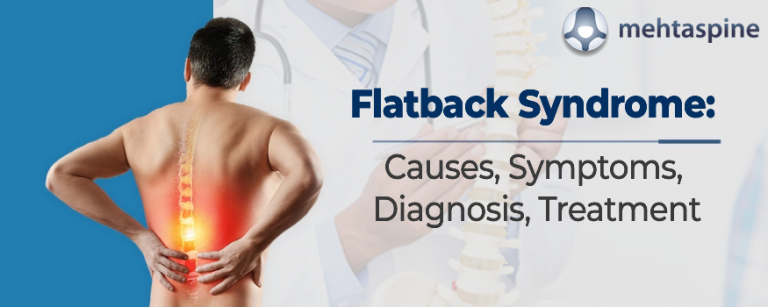 Flatback Syndrome: Causes, Symptoms, Diagnosis and Treatment