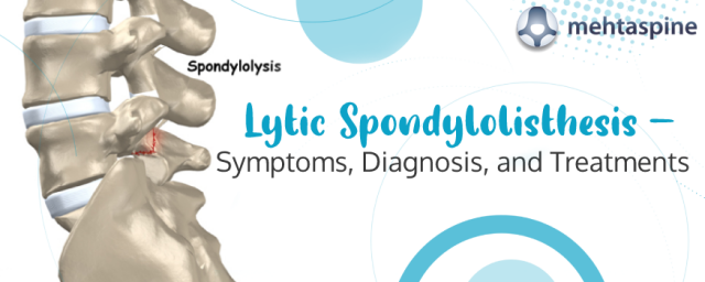 Lytic Spondylolisthesis - Symptoms, Diagnosis, and Treatments