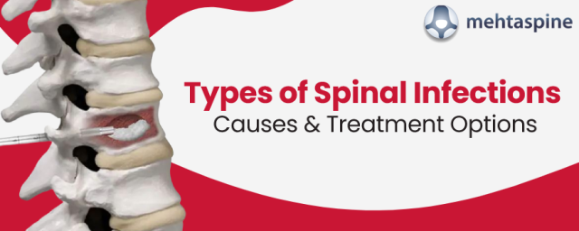 How serious an infection in the spine can be? | Mehta Spine