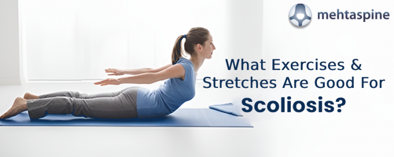 Scoliosis Exercises to Straighten Spine | Jwalant Mehta