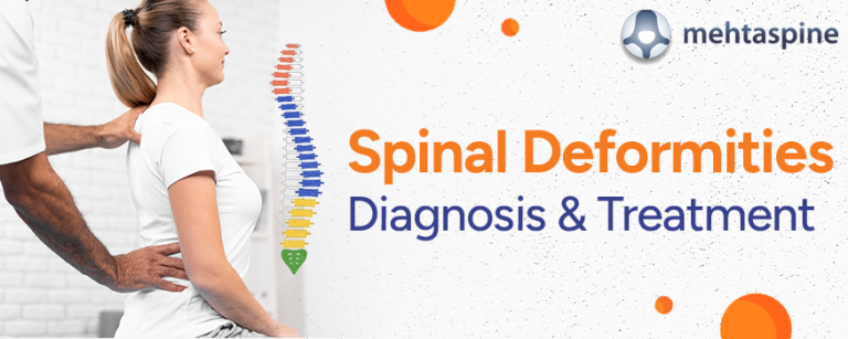 Spinal Deformities: Diagnosis & Treatment